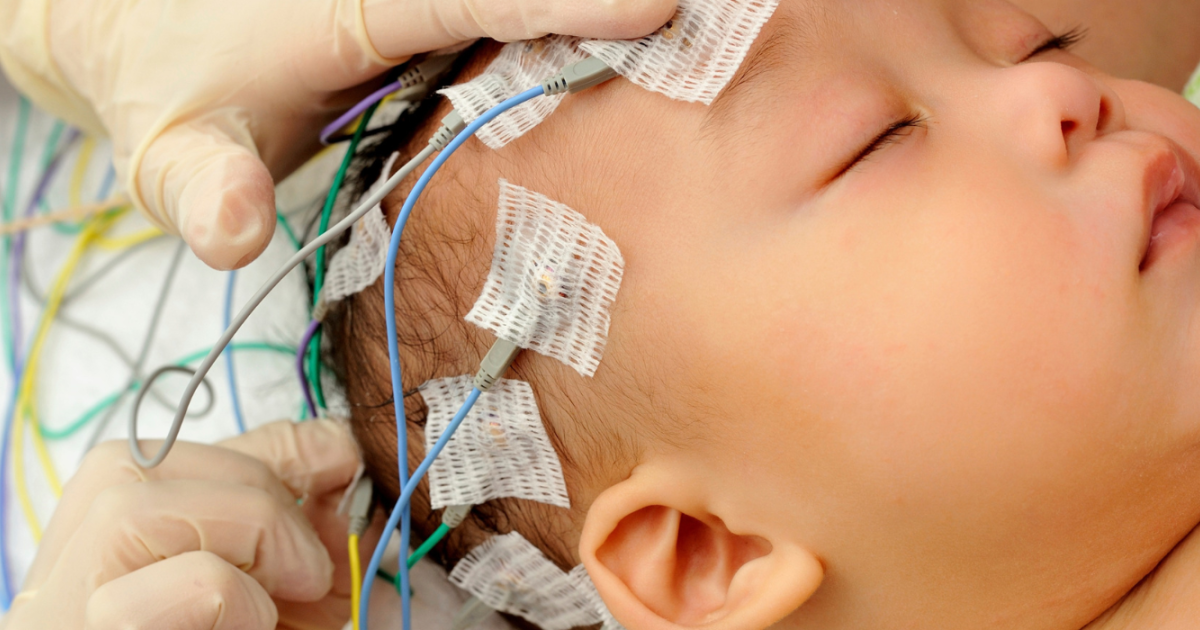 Health & research | Young Epilepsy